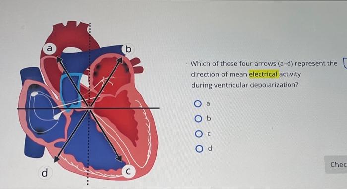 Solved Order these images of the electrical axis over the | Chegg.com