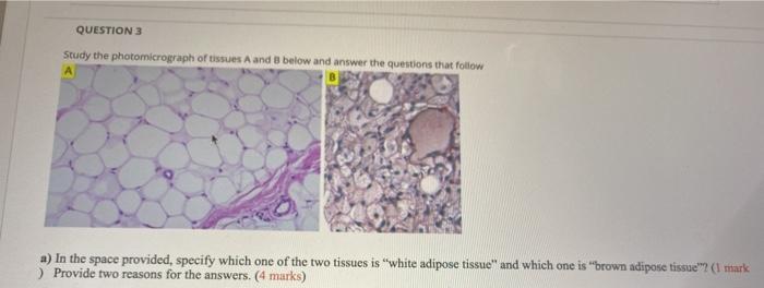 Solved QUESTION 3 Study the photomicrograph of tissues A and | Chegg.com
