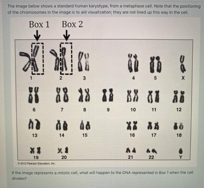 Solved The image below shows a standard human karyotype, | Chegg.com