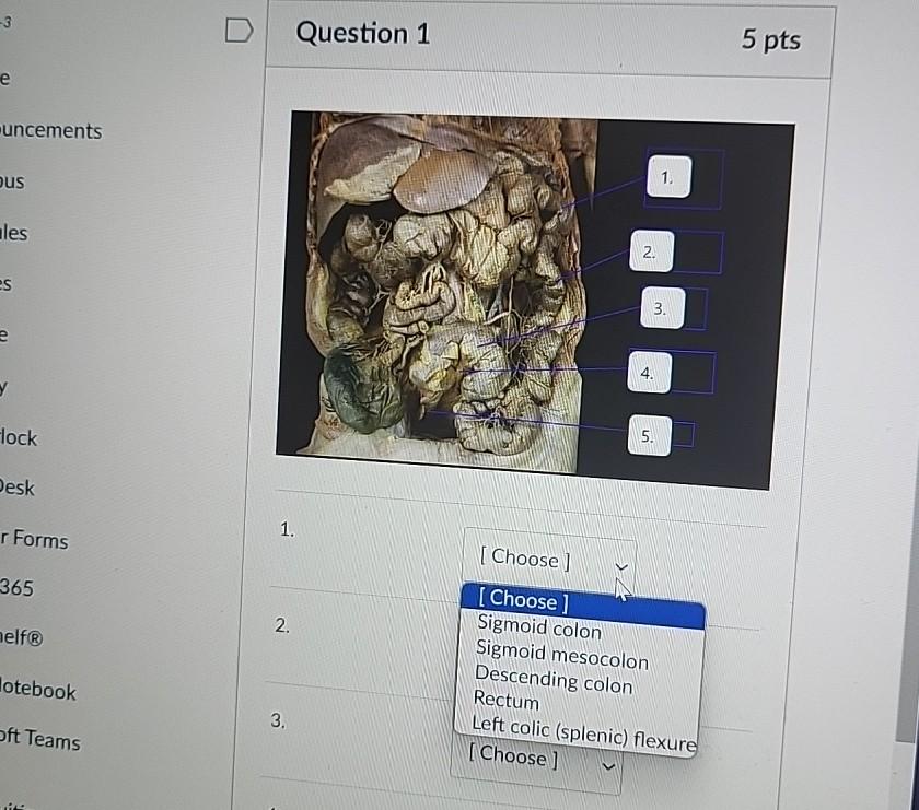 Solved Question 15 ﻿pts1.[Choose][Choose]2.Sigmoid | Chegg.com