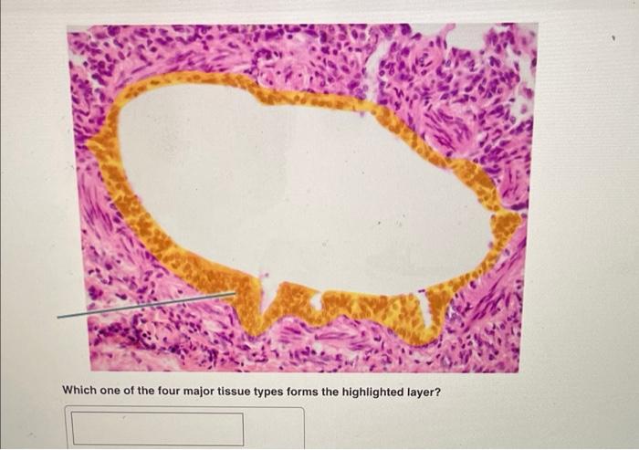 Solved Identify the highlighted structure. Identify the | Chegg.com