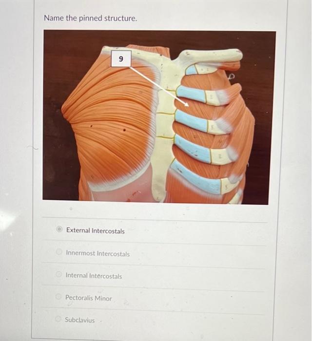 Solved Name the pinned structure. External Intercostals | Chegg.com