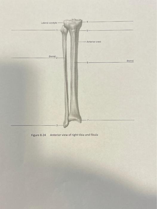 Solved Lateral condylo -5 Anterior est (bone) bone 6 Figure | Chegg.com