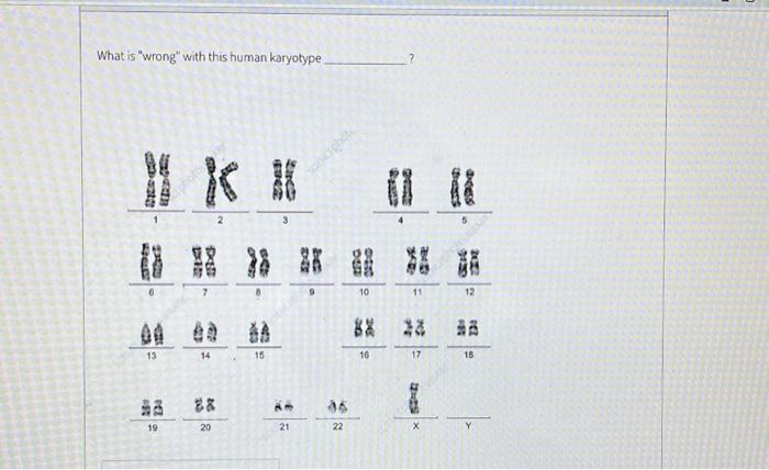 Solved What is "wrong" with this human karyotype 1 6 13 19 7 | Chegg.com