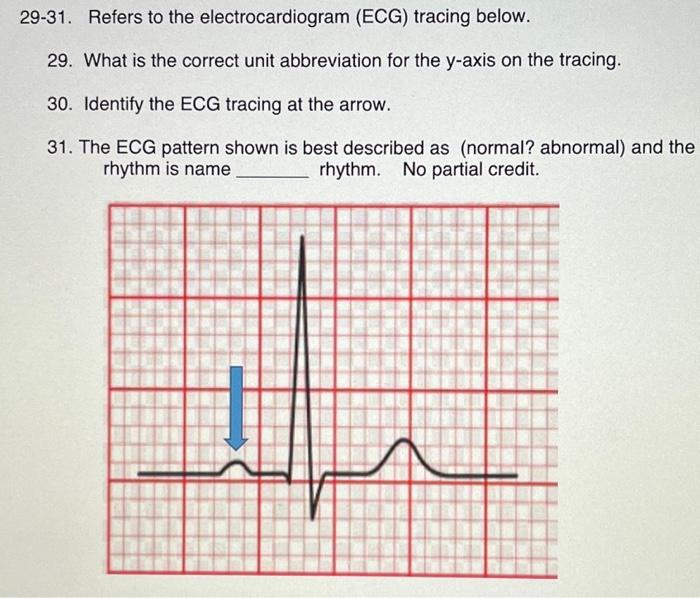 Solved 9-31. Refers to the electrocardiogram (ECG) tracing | Chegg.com