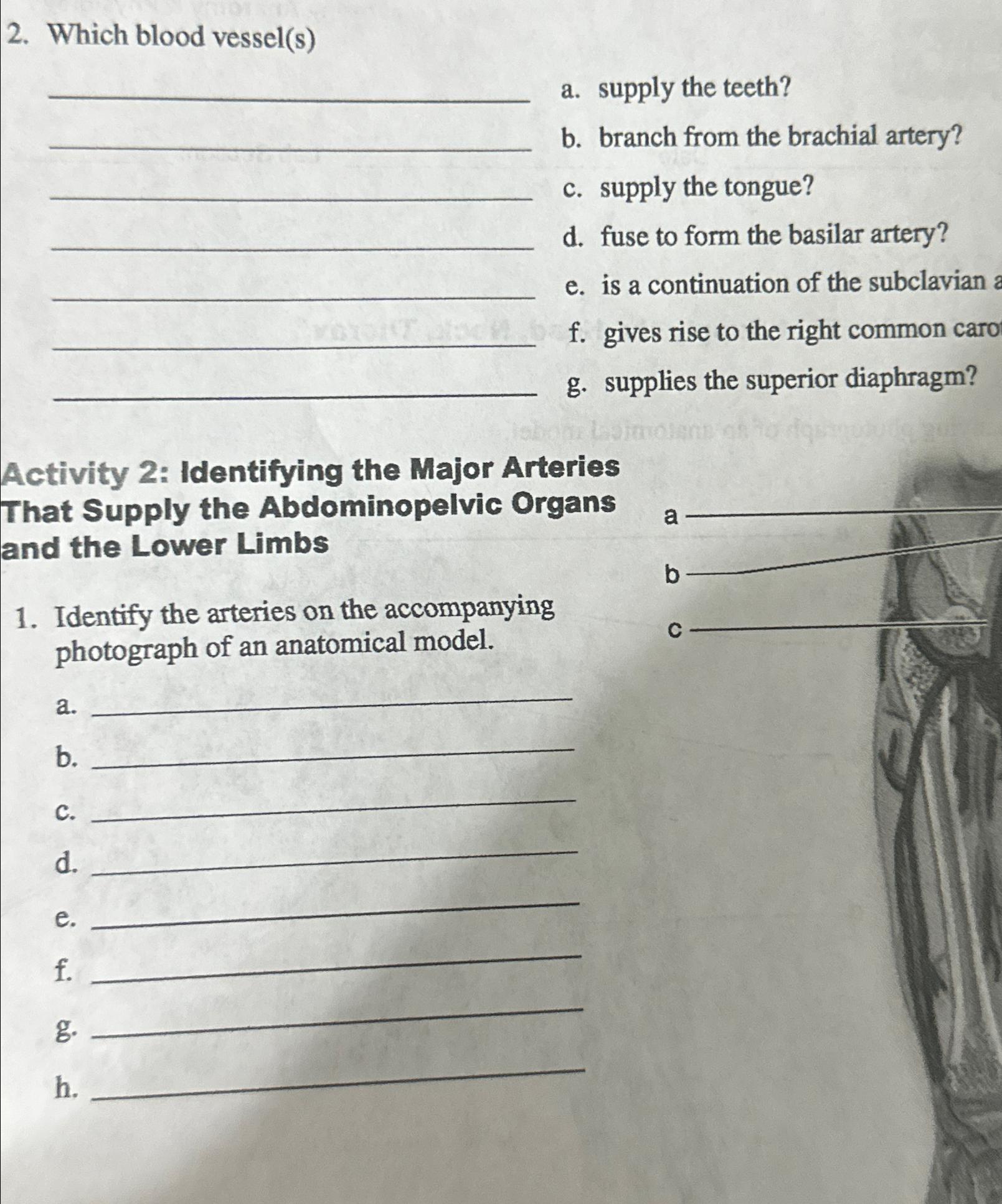 Solved Which blood vessel(s)a. ﻿supply the teeth?b. ﻿branch | Chegg.com