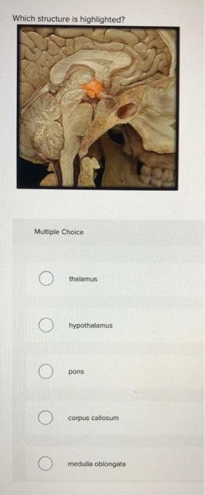 Solved Which structure is highlighted? Multiple Choice | Chegg.com