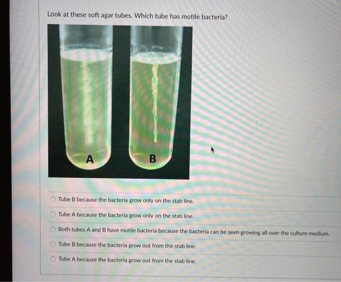 Solved Look at these soft agar tubes. Which tube has motile | Chegg.com