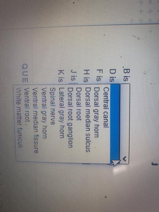 Solved Label each of the spinal cord cross section models | Chegg.com