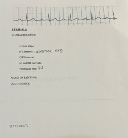 Solved CHARACTERISTICS:p wave shape:p-R interval ownormce | Chegg.com
