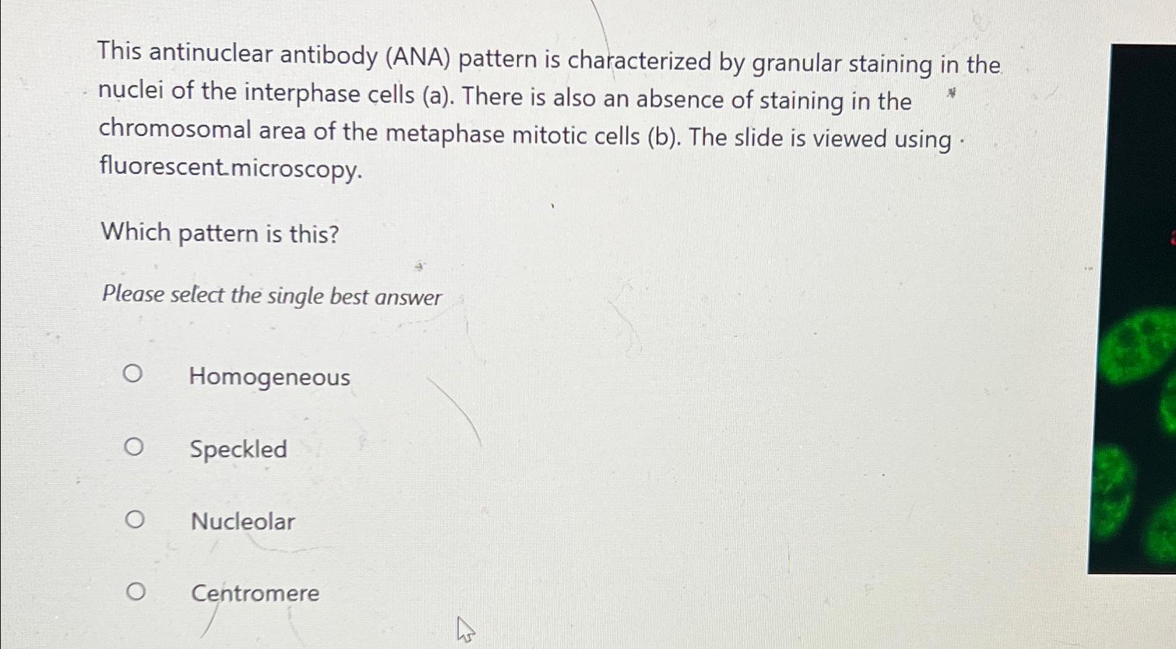 Solved This antinuclear antibody (ANA) ﻿pattern is | Chegg.com