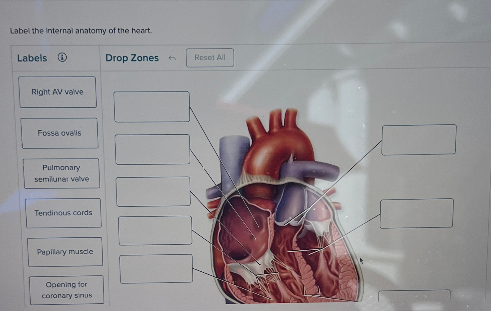 Solved Label the internal anatomy of the heart. | Chegg.com