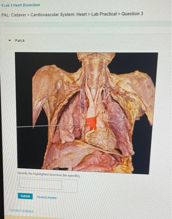 Solved Cardiovascular System: Heart > Lab Practical > | Chegg.com