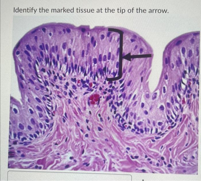 Solved Identify the marked tissue at the tip of the arrow. | Chegg.com