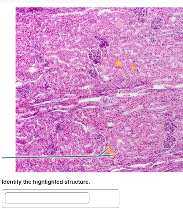 Solved PAL: Histology > Urinary System > Lab Practical > | Chegg.com