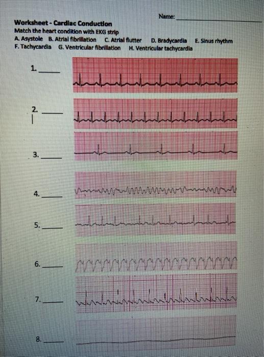 Solved Name: Worksheet - Cardiac Conduction Match the heart | Chegg.com