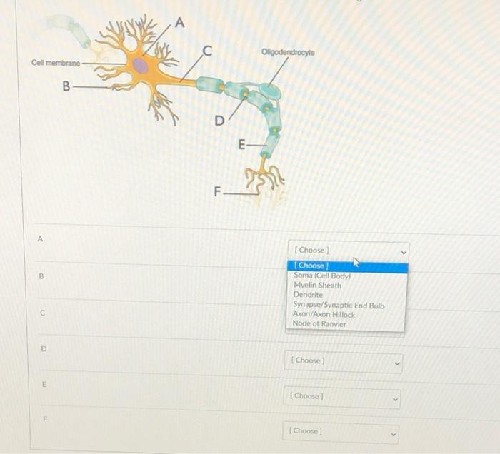 Solved Match the description on the left with the term on | Chegg.com