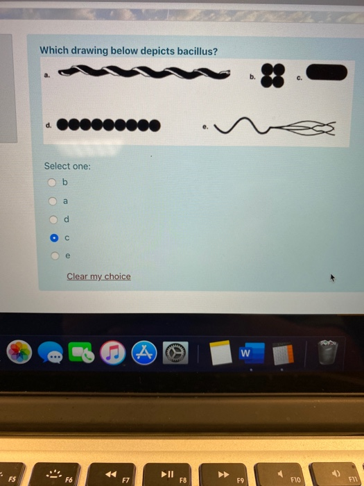 Solved Which drawing below depicts bacillus? a wееееем | Chegg.com