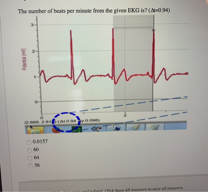 Solved The number of beats per minute from the given EKG is? | Chegg.com