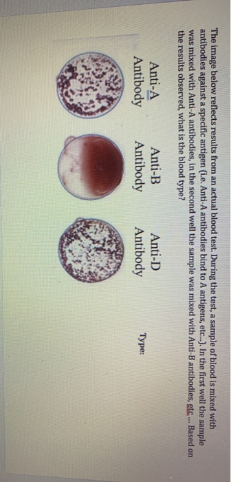 Solved A A А В D RBC RBC RBC A A BA D Surface antigens | Chegg.com