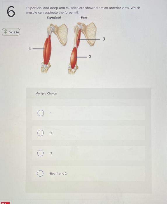 Solved Superficial and deep arm muscles are shown from an | Chegg.com