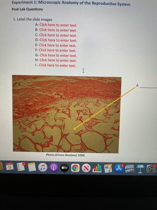 Solved Experiment 1: Microscopic Anatomy of the Reproductive | Chegg.com