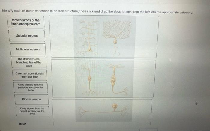 Solved Identify each of these variations in neuron | Chegg.com