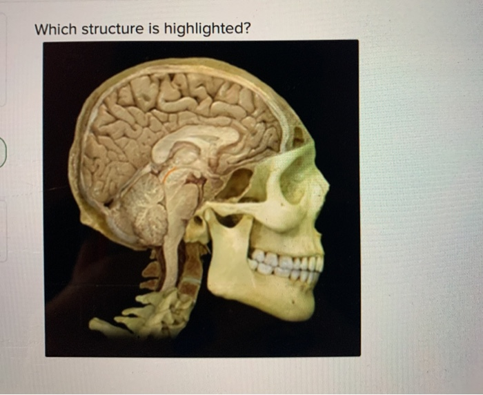 Solved Which structure is highlighted? | Chegg.com
