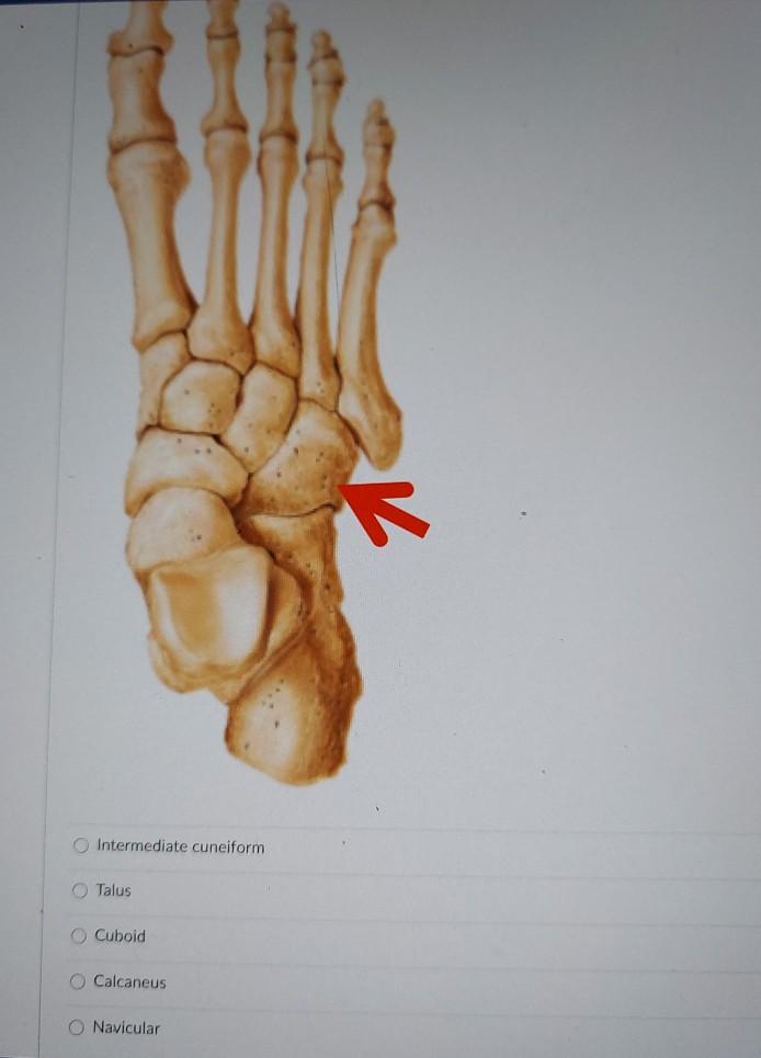 Solved Identify the structure indicated by the red arrow. o | Chegg.com
