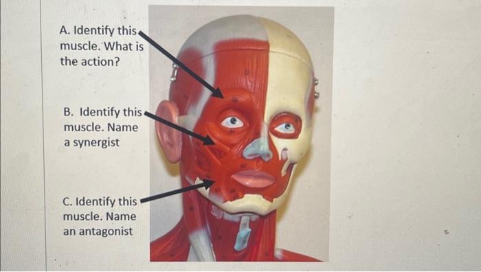 Solved A. Identify this muscle. Name an antagonist | Chegg.com