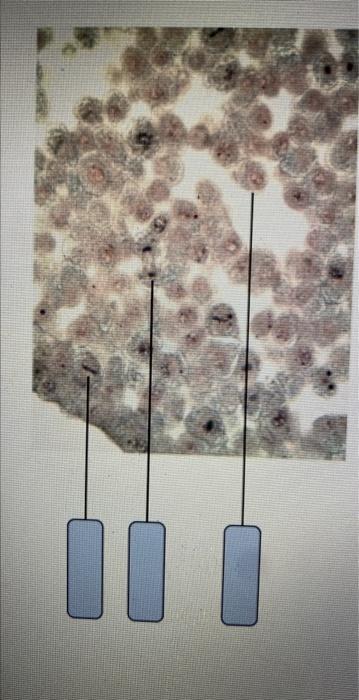 Complete the labeling activity by identifying each | Chegg.com