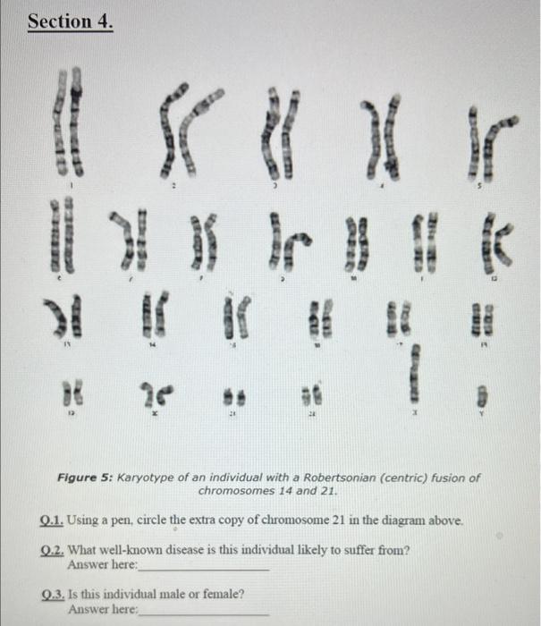 Solved Figure 1: Normal human male (46,XY ) karyotype. | Chegg.com