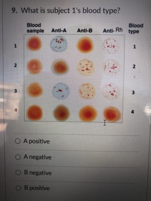 Solved 9. What is subject 1's blood type? Blood sample | Chegg.com