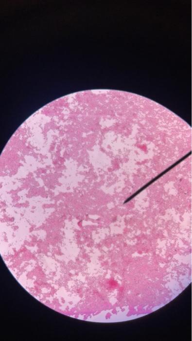Solved identify the unknown morphology | Chegg.com