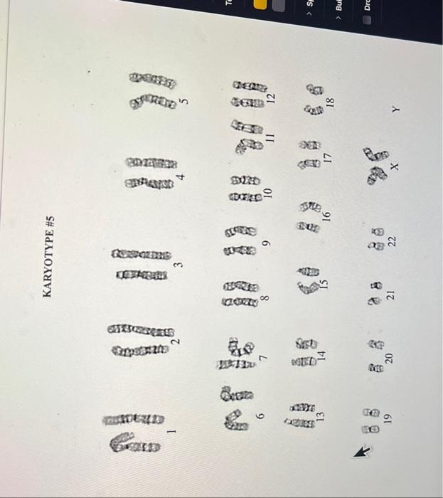 Solved 6. Examine the following karyotypes and answer the | Chegg.com