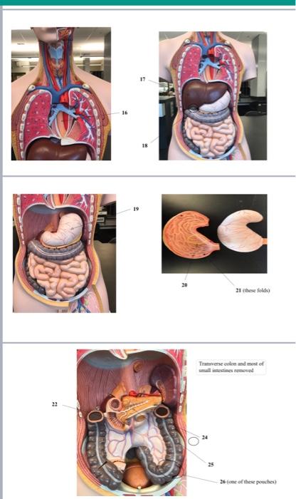 Solved 2 21 these folds) Terriest a 25 | Chegg.com