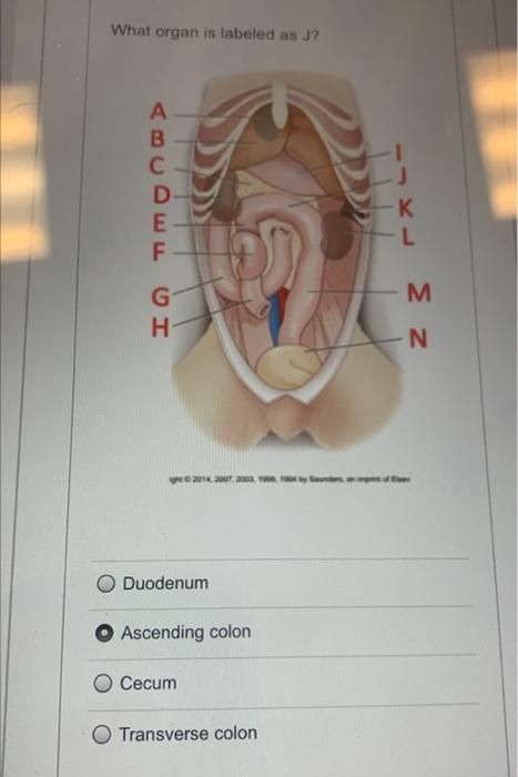 Solved What organ is labeled as J ? Duodenum Ascending colon | Chegg.com