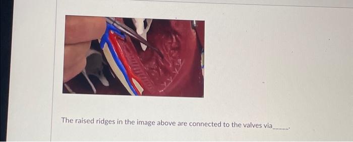 Solved The raised ridges in the image above are connected to | Chegg.com