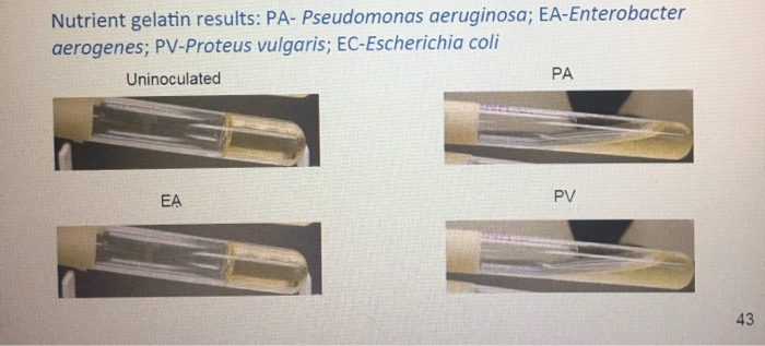 Solved Urease results: PA- Pseudomonas aeruginosa; | Chegg.com