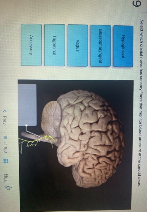 Solved Facial Sn Hypoglossal Glossopharyngeal Trigeminal Chegg solved-facial-sn-hypoglossal-glossopharyngeal-trigeminal-chegg
