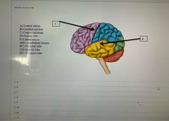 Solved ldentity structure 8 : Identify structure #7 A) | Chegg.com