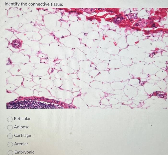 Reticular Adipose Cartilage Areolar Embryonic | Chegg.com