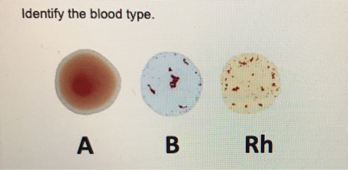 Solved Identify the blood type. A B Rh | Chegg.com