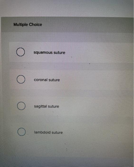 Solved Which structure is highlighted? Multiple Choice O O | Chegg.com