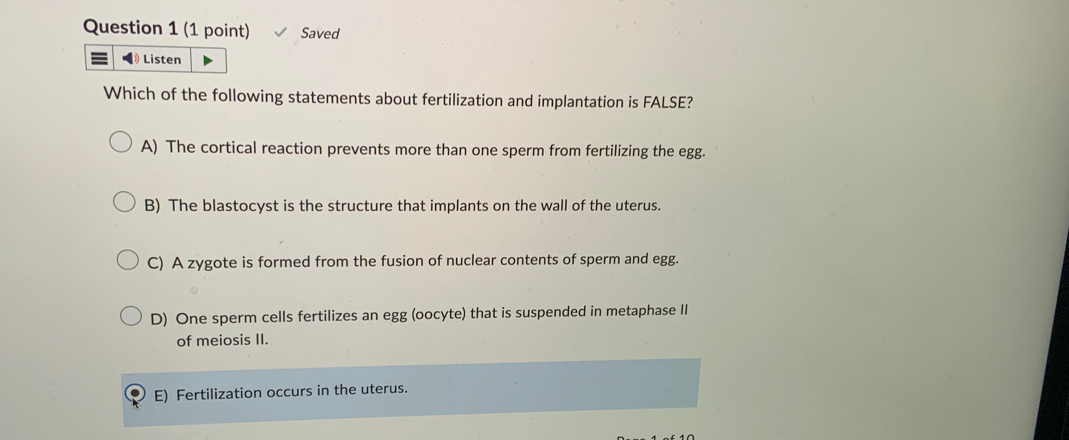Solved Question 1 (1 ﻿point)Which of the following | Chegg.com