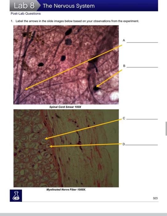 Solved Lab 8 The Nervous System Post-Lab Questions 1. Label | Chegg.com