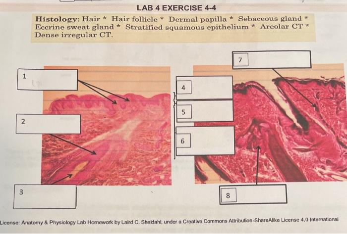 Solved LAB 4 EXERCISE 4-4 Histology: Hair * Hair follicle * | Chegg.com