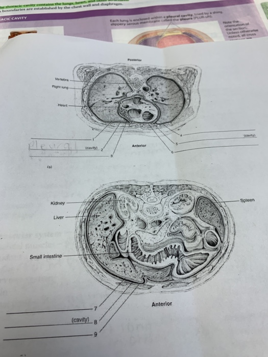 Solved boundaries are established by the chest wall and TACK | Chegg.com