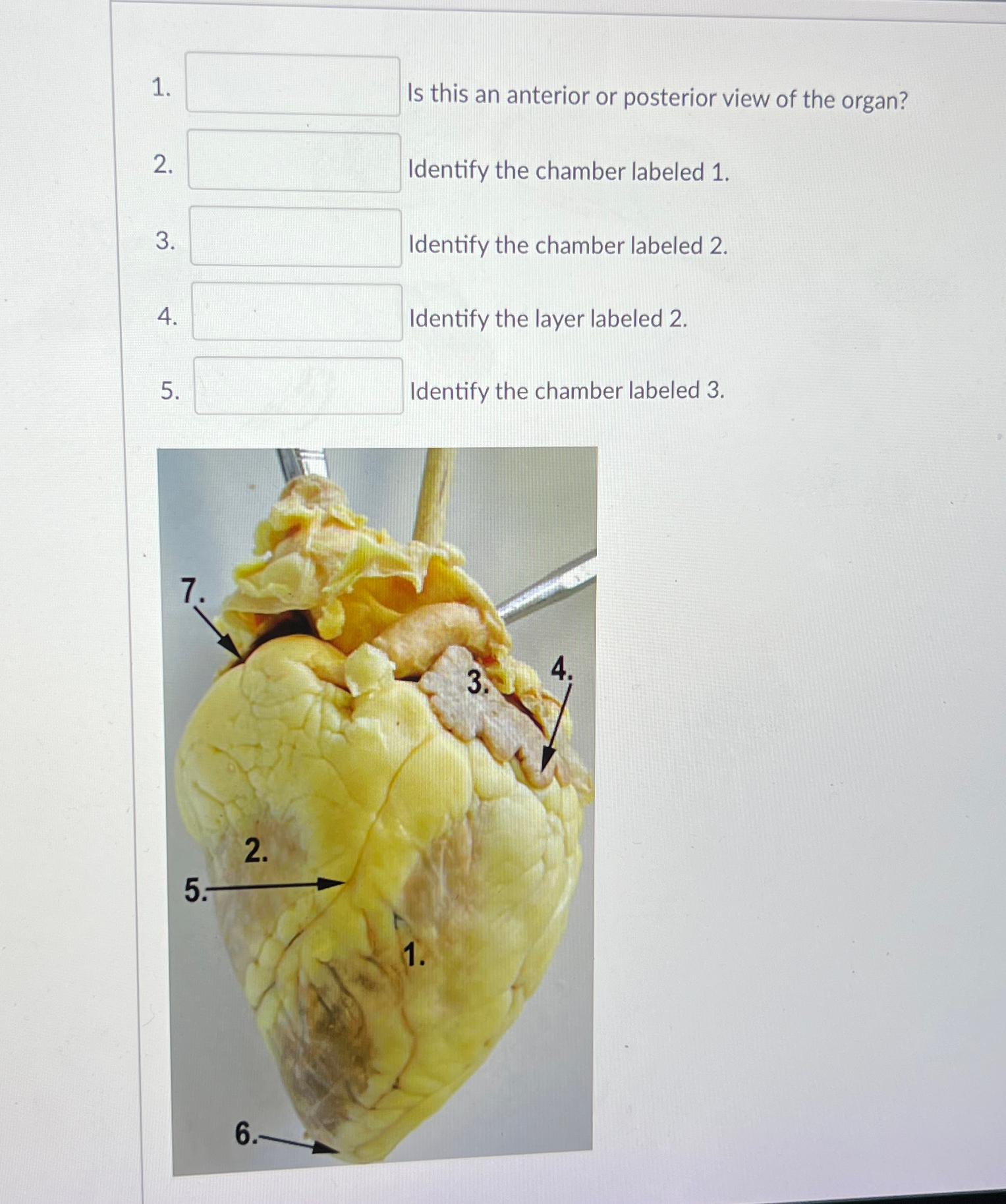 Solved Is this an anterior or posterior view of the | Chegg.com