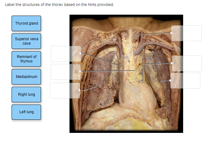Solved Label the structures of the thorax based on the hints | Chegg.com